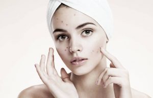 Skin Blemishes | True You Skin Clinics